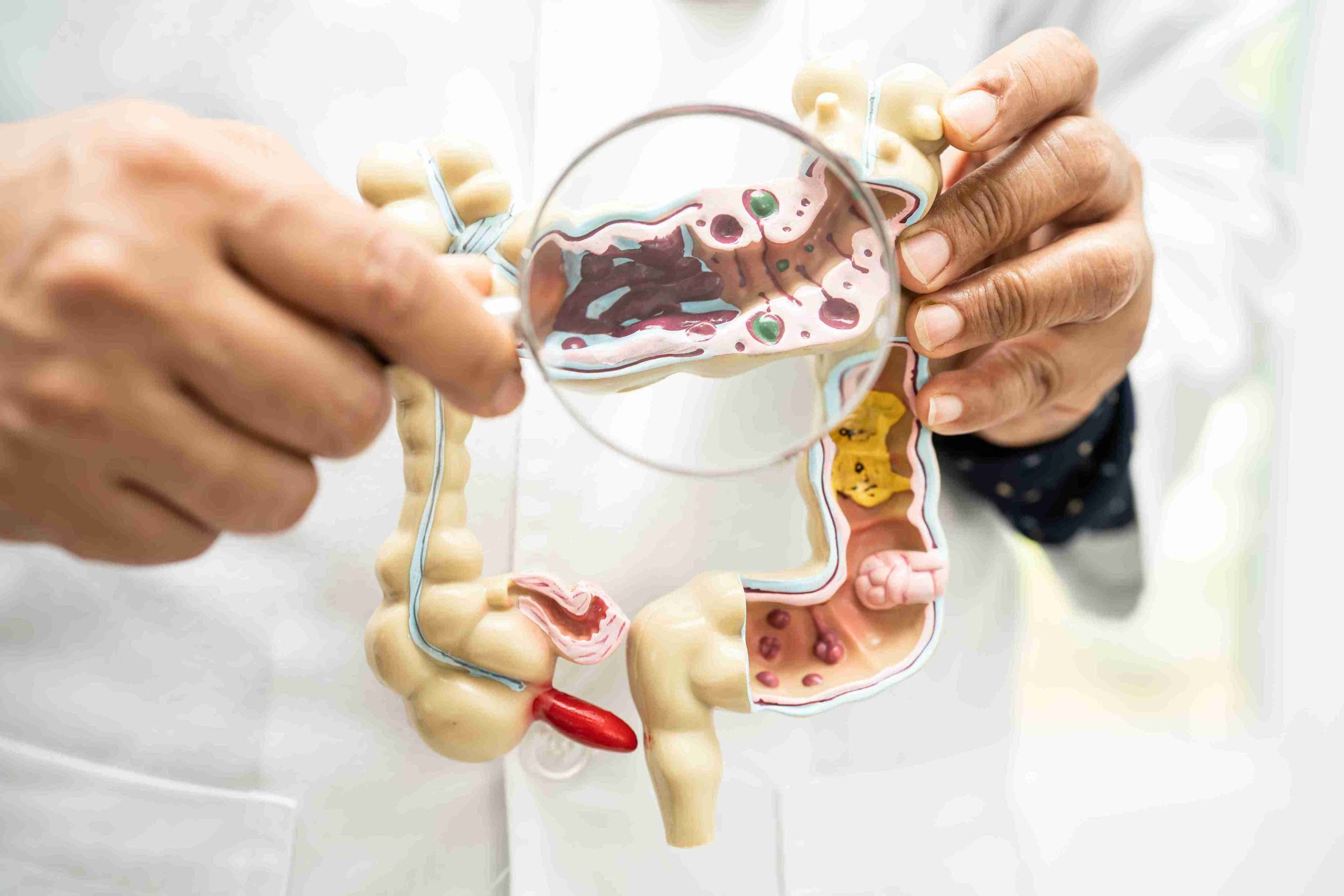 Common Findings During Colonoscopy Screening | Curasia